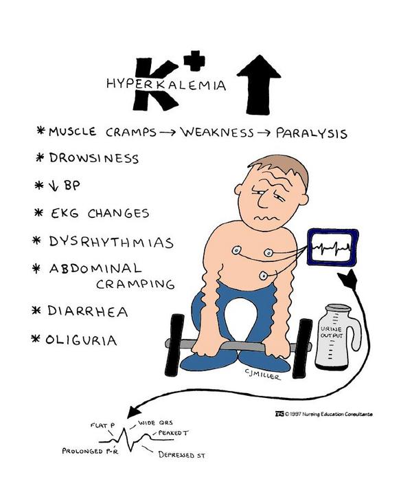 narsingPH: Hyperkalemia