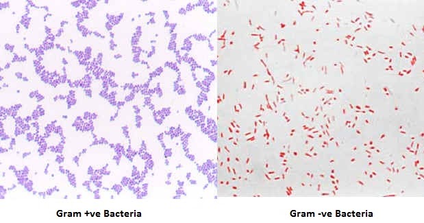 Pewarnaan Gram ~ Pengantar Analisis Mikrobiologi