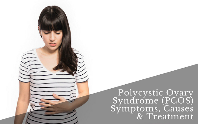 Polycystic Ovary Syndrome (PCOS) Symptoms