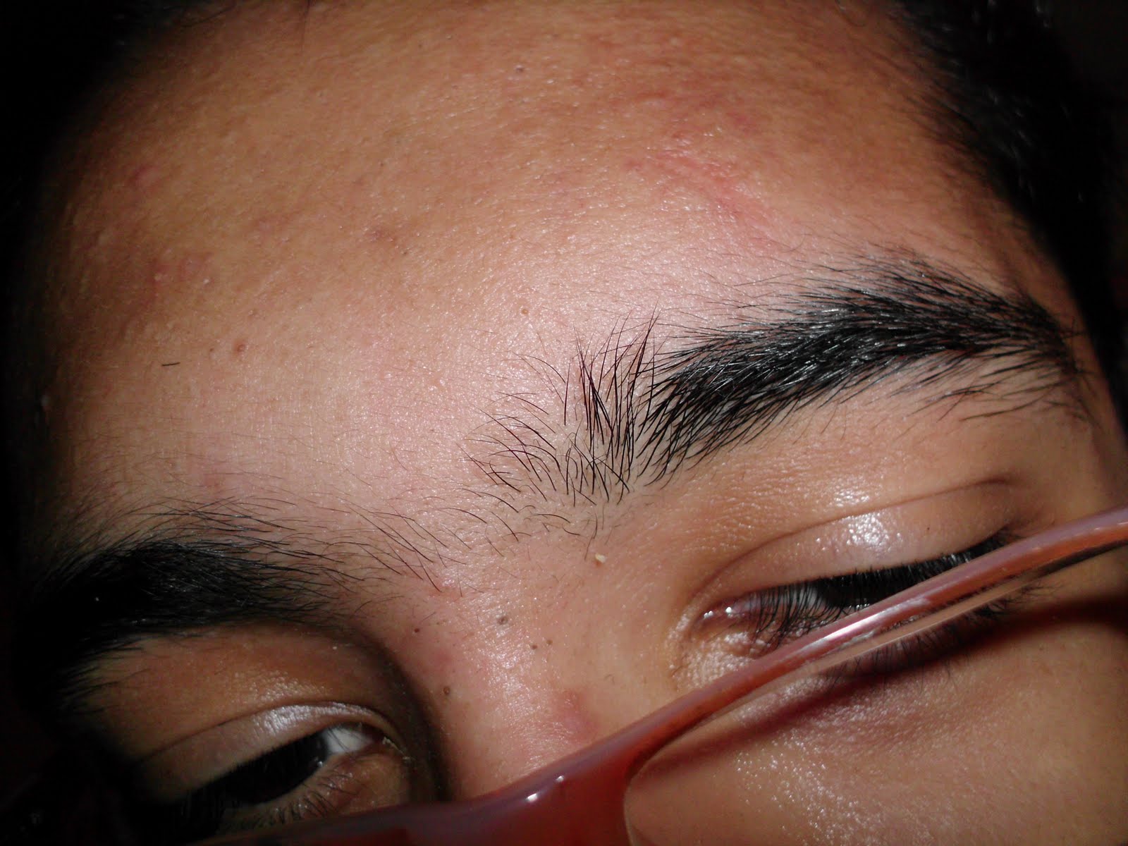 ck3c's: Hole in one's....forehead?