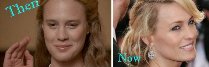 Robin Wright Plastic Surgery