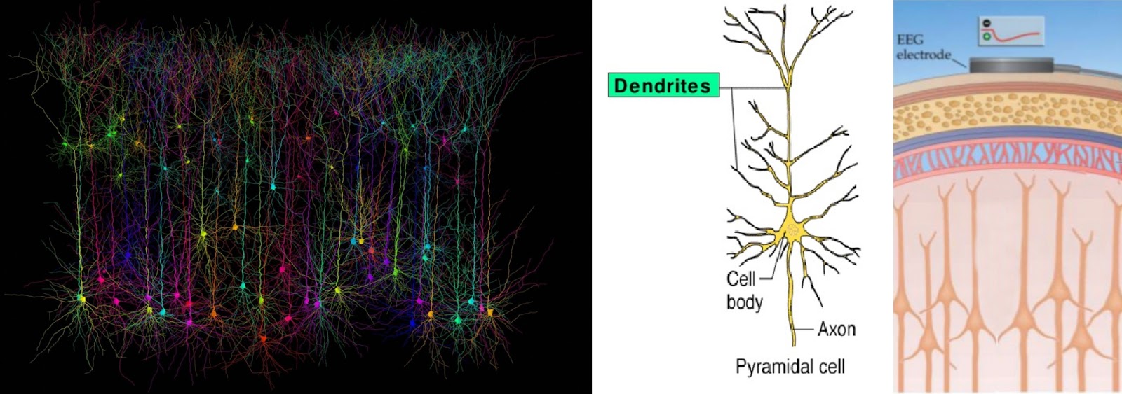 Técnicas de Neuromarketing (III): EEG - Brain and Marketing