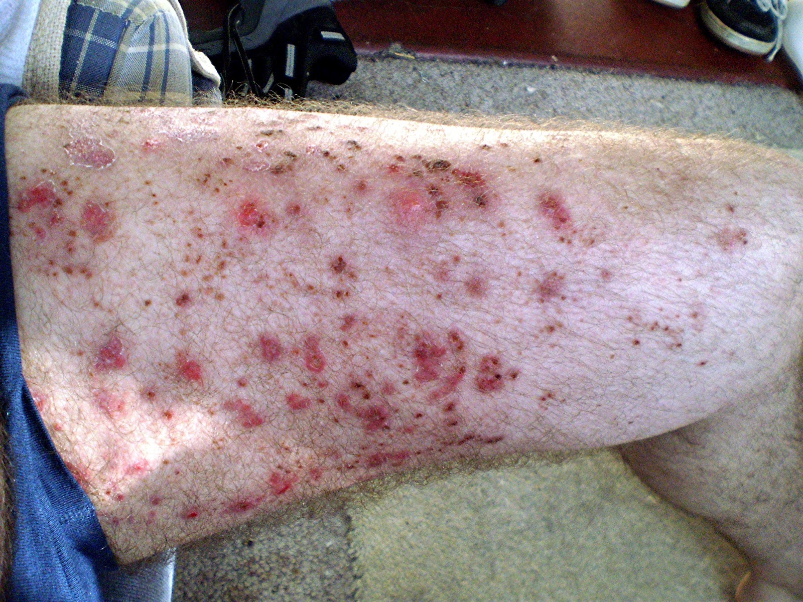 Life with HIV: February 2012