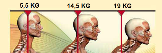 QUIROPRACTICO IGNACIO DÍAZ: RECTIFICACIÓN DE LA LORDOSIS CERVICAL