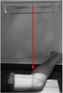 Ryanggraini : Proyeksi pemeriksaan Genu