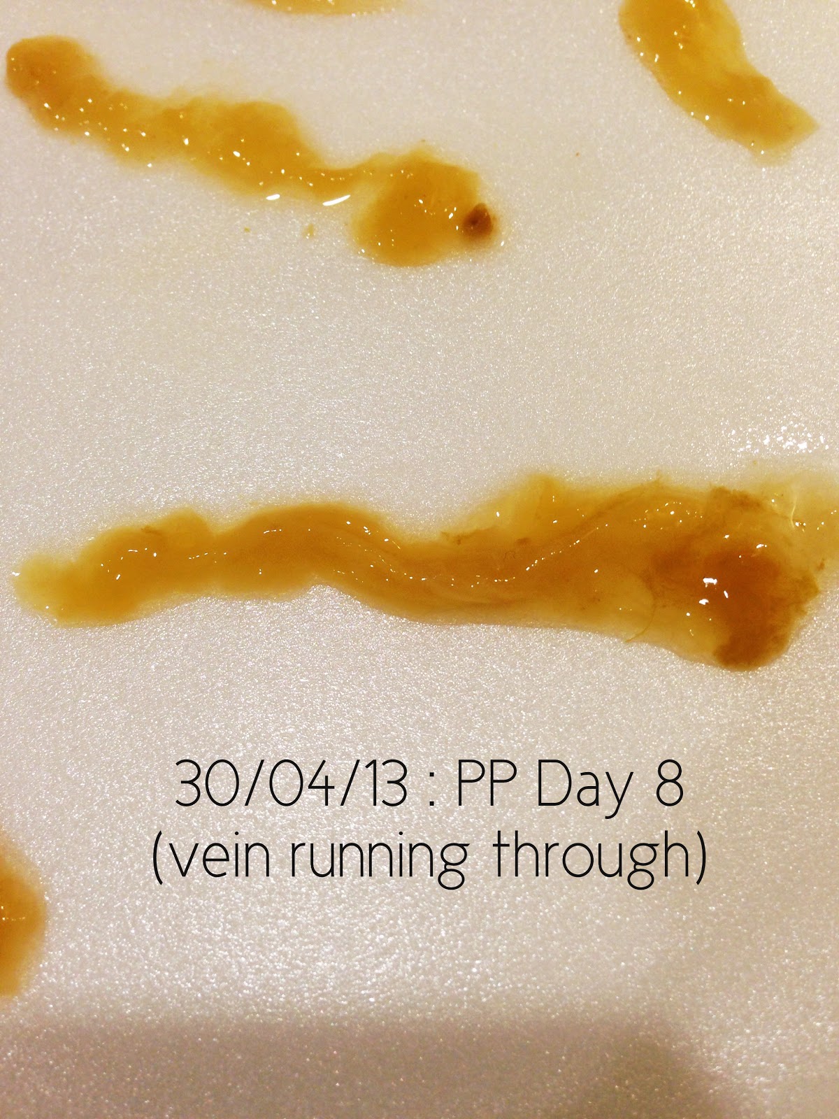 A Drop At A Time: Parasite Protocol Round 1 : Day 8