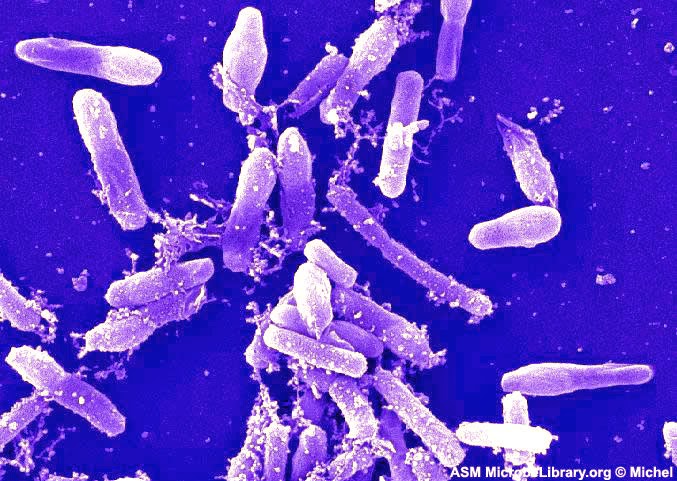 Higiene e Segurança Alimentar: Toxinfecção alimentar: Bacillus cereus