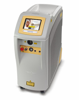 Libre De Celulitis: Laser Para Celulitis – El Cellulaze