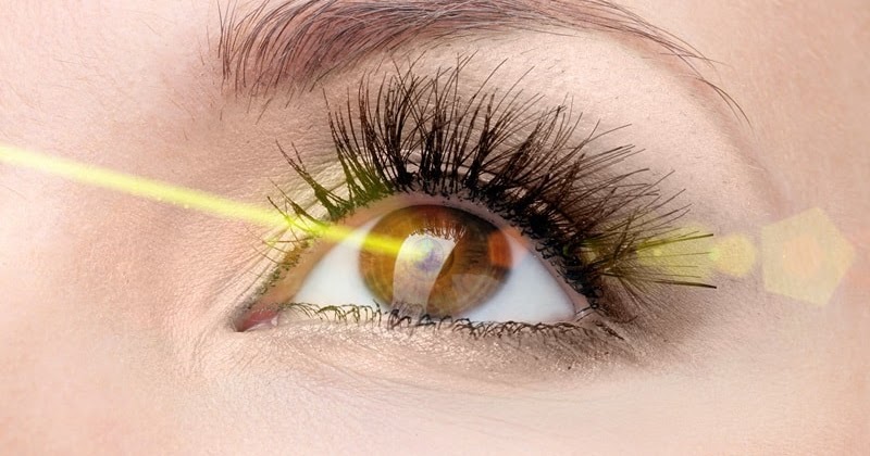 Bogotá láser: 4 datos curiosos sobre la cirugía láser