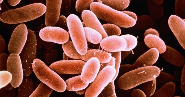 Listeria: Listeria- Why- What- Where- How? Listeria Recall Hits Costco 2016