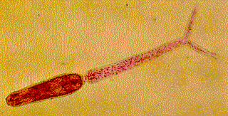 Universo Parasito: ESQUISTOSSOMÍASE