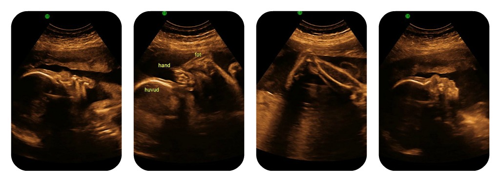 Bekkas blogg: 3D/4D Ultraljud idag :) (25+3)