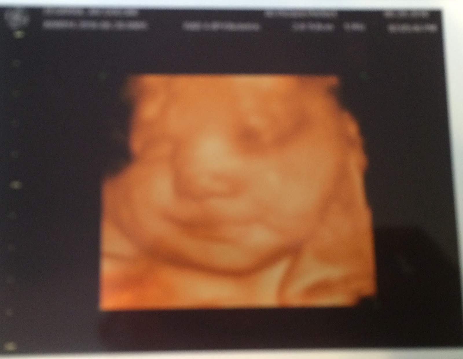 Loved You Then, Love You Still, Always Have & Always Will : 33 Weeks