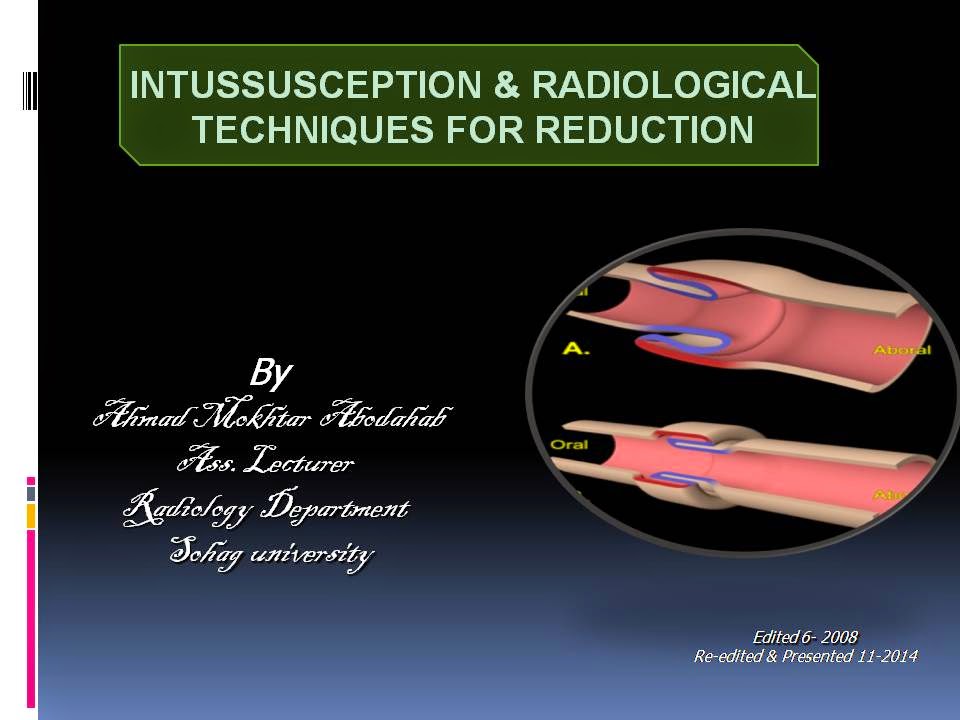 Radiology Sohag: 2014