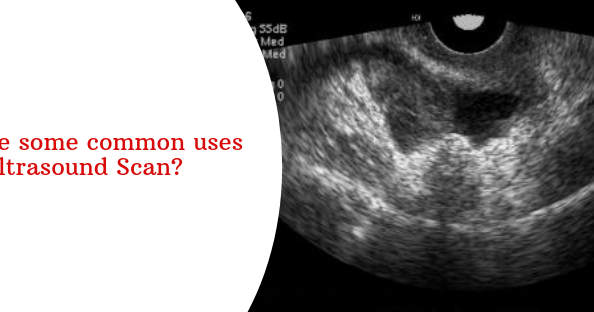 General Ultrasound Scan Preparation | Ultrasound Scan in Bangalore