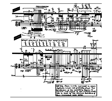 ugEXPLODE: Why Listen To Complex Music?