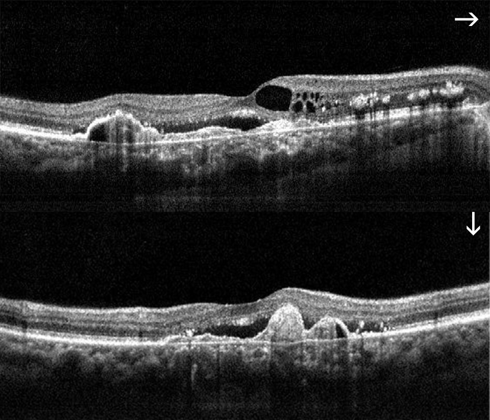 Dr Daniel Pace & Dr Adam Rudd (Family Vision Care of Bountiful ...
