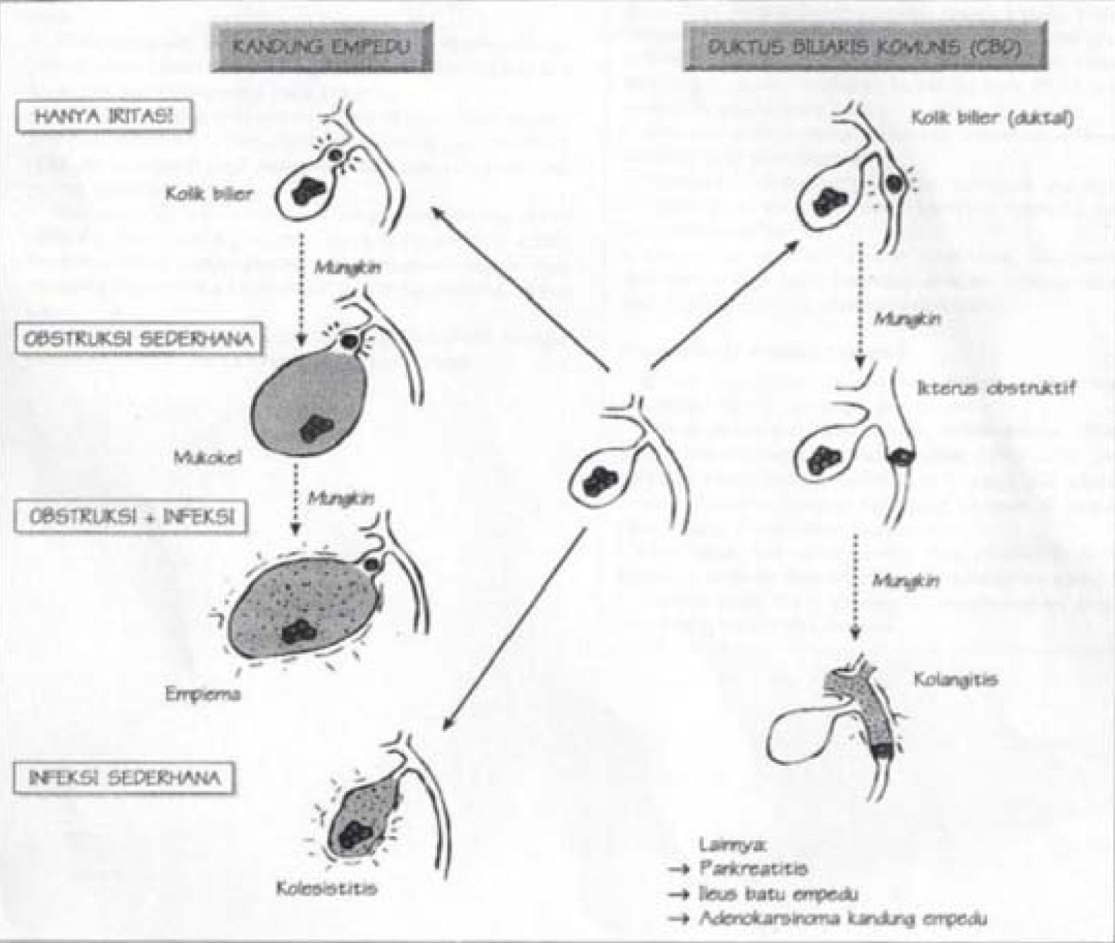 Kolelitiasis (Batu Empedu) ~ Informasi Kedokteran Dan Kesehatan