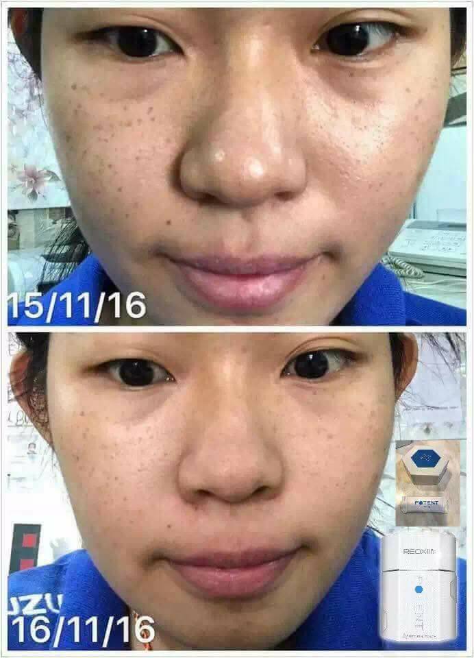 REDOXY RETURN LEGACY: POTENT ESSENTIAL 2 SYSTEM 双向激活系统