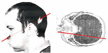 10 People Who Survived the Impossible | worldbizarre-things