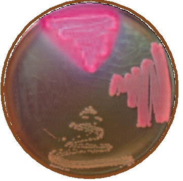 [Microbiology] Desoxycholate Agar | Free Medical Atlas