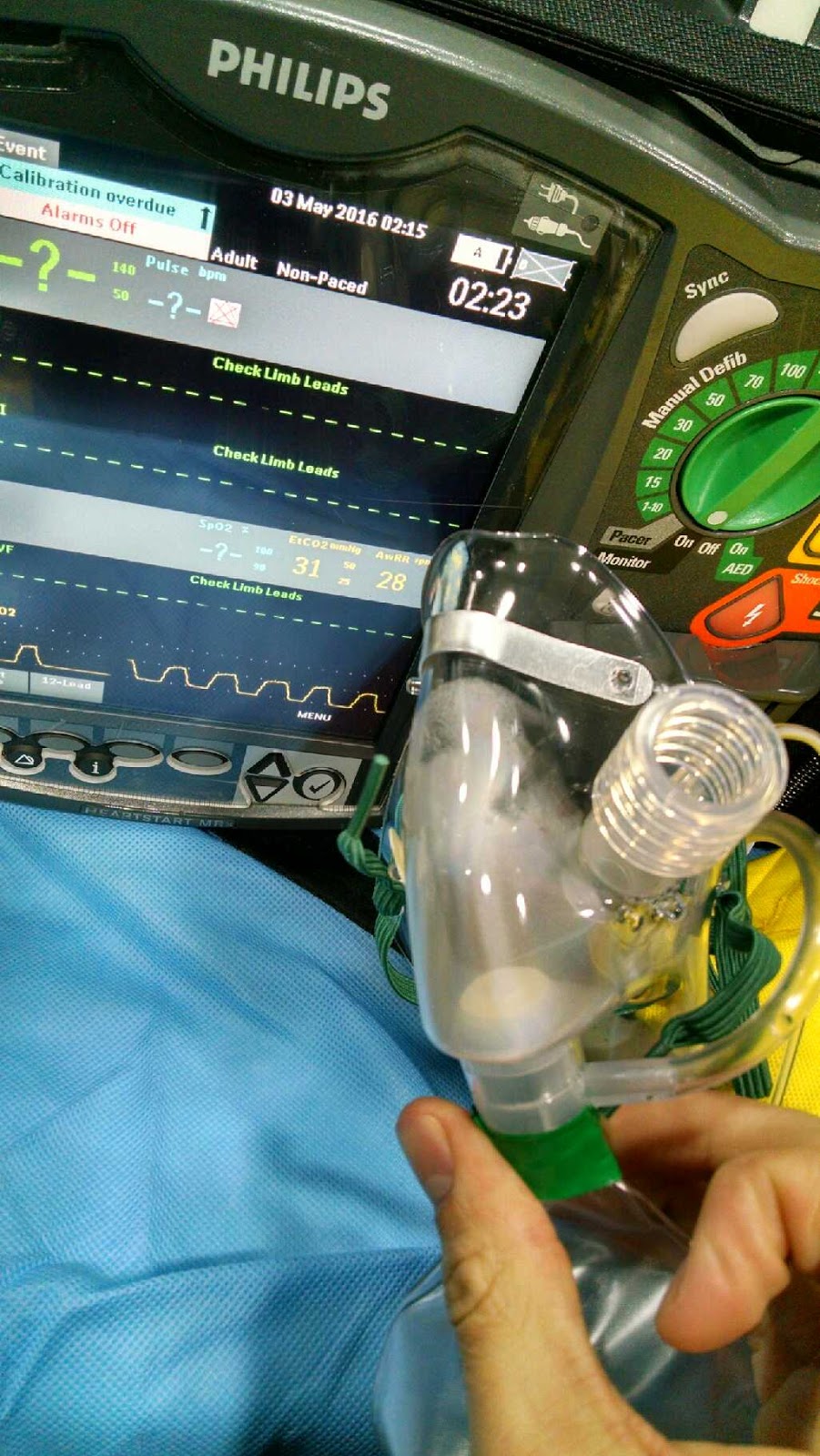 Capnography device - sratfaith