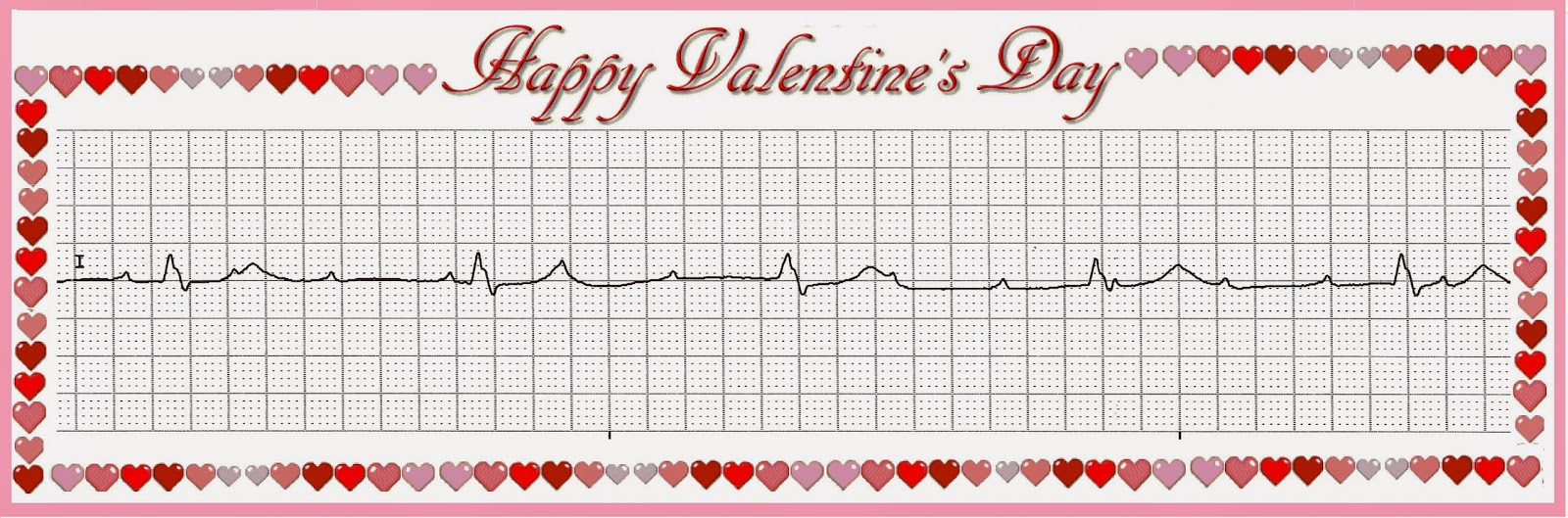 Practice EKG Strips (Valentine's Day)