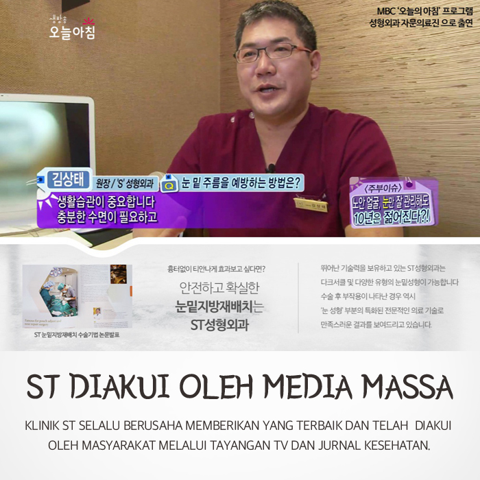 Teknik Pembedahan Kelopak Mata Ganda Jahitan Natural dari Dokter Terbaik