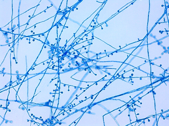 Fun With Microbiology (What's Buggin' You?): Blastomyces dermatitidis