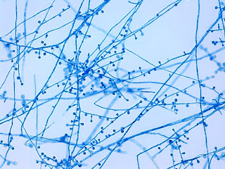 Blog de Microbiología UP TM-27: Hongos dimórficos