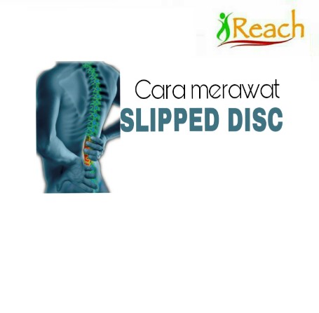 CARA MERAWAT SLIP DISC