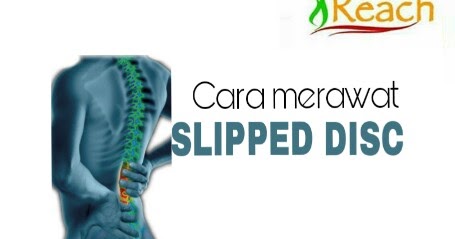 CARA MERAWAT SLIP DISC