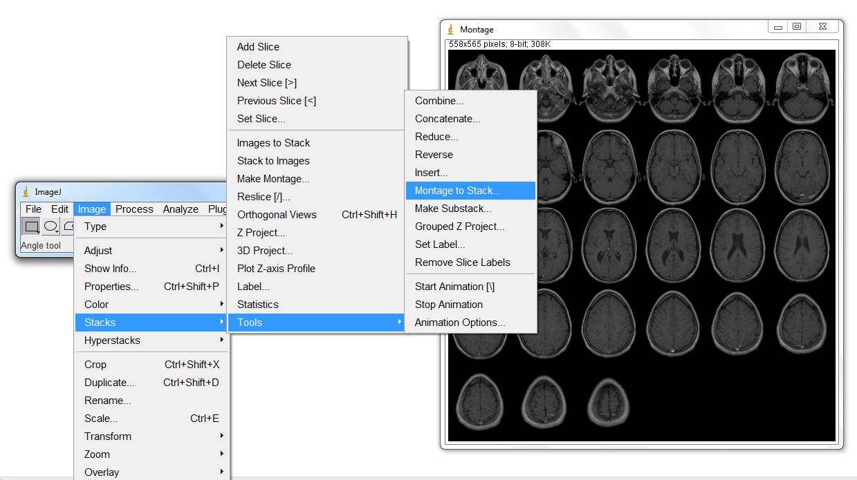 My imageJ: เมนู Image with ImageJ [ตอนที่ 38] Stacks tools, การแปลงภาพ Montage เป็น Stack