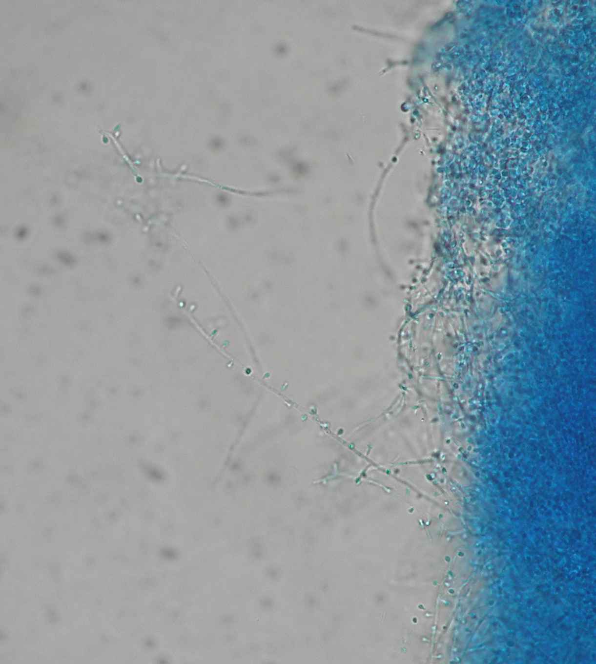 ATLAS MICOLOGIA: TRICHOPHYTON RUBRUM