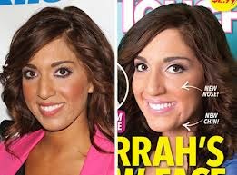 Farrah Abraham Plastic Surgery Before and After Nose Job, Chin Implants ...
