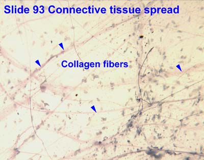 HISTOLOGY PICTURES: Connective Tissue