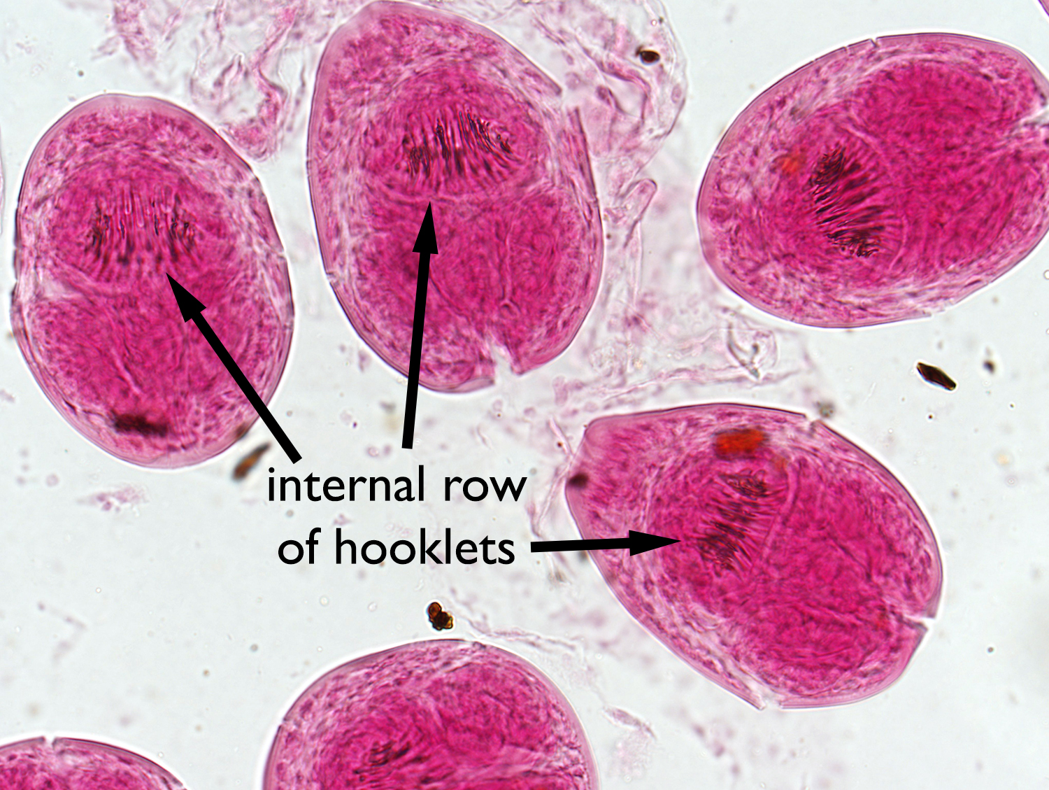 Creepy Dreadful Wonderful Parasites: Answer to Case 423