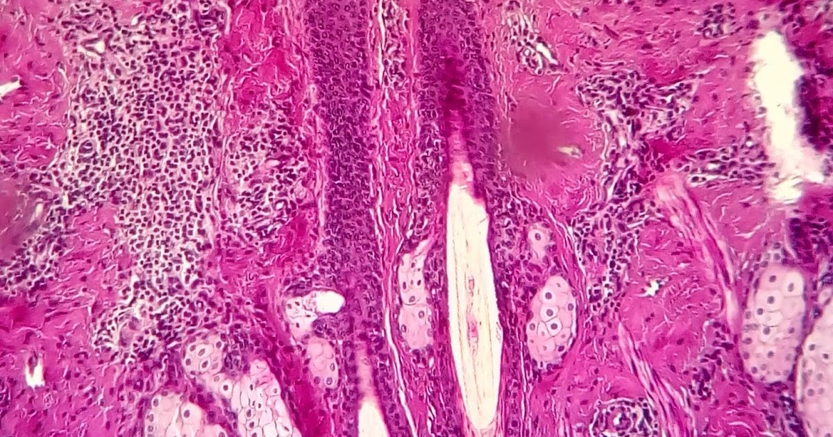 Manual interactivo de tejido conectivo: Piel