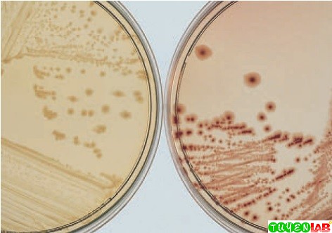 [Microbiology] Atlas of Enterobacteriaceae | Free Medical Atlas