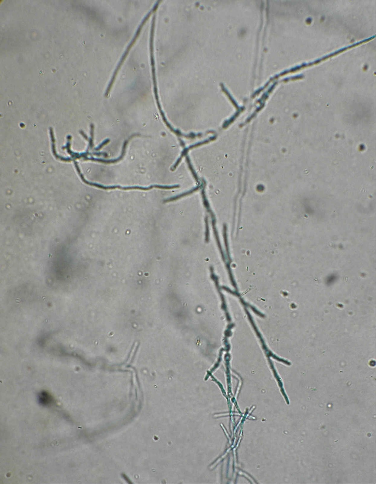 ATLAS MICOLOGIA: TRICHOPHYTON SOUDANENSE
