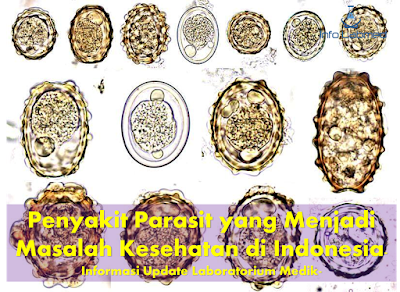Penyakit Parasit yang Menjadi Masalah Kesehatan di Indonesia | Seri ...