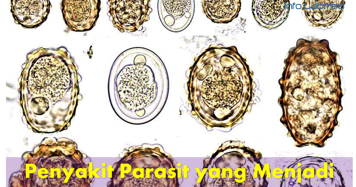 Penyakit Parasit yang Menjadi Masalah Kesehatan di Indonesia | Seri ...