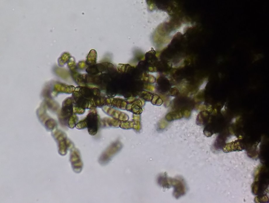 Myco Magic: Dematiaceous hyphomycetes