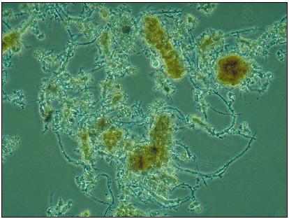 Microbiologie des boues activées | Traitement Des Eaux Usées