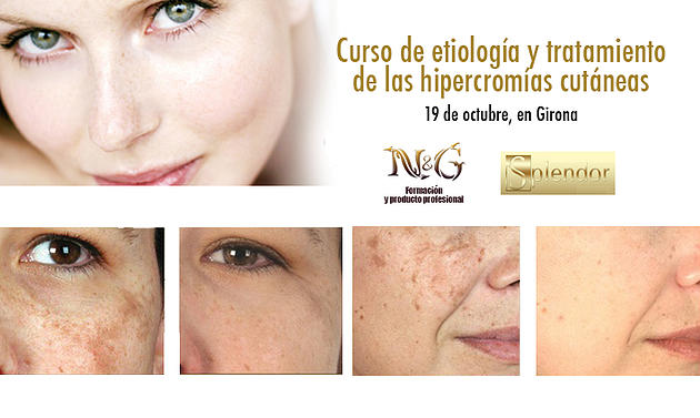 N&G Formación y Producto Profesional: Curso de etiología y tratamiento ...