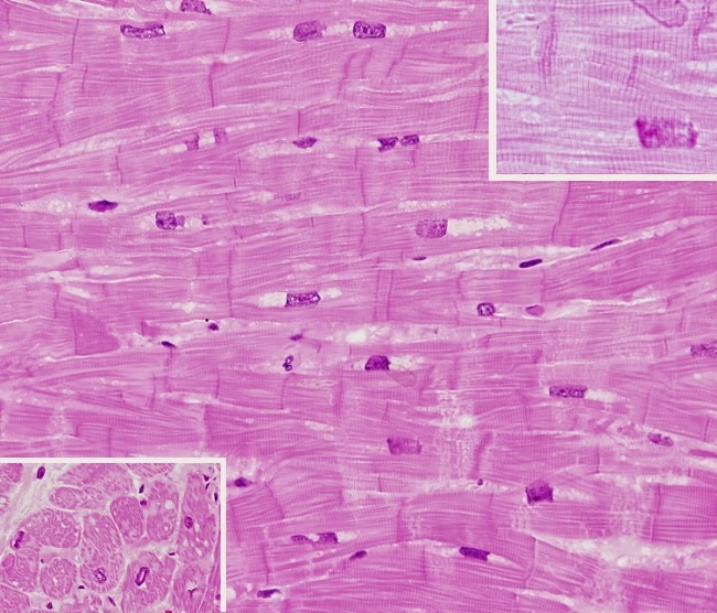 Andrea: TEIXIT MUSCULAR