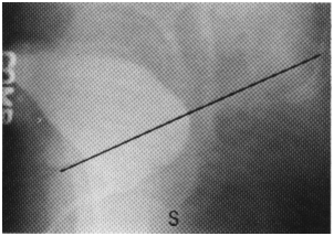 Radiographic Urethrocystography part 1