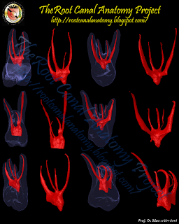 The Root Canal Anatomy Project: Four-Rooted Maxillary Second Molars