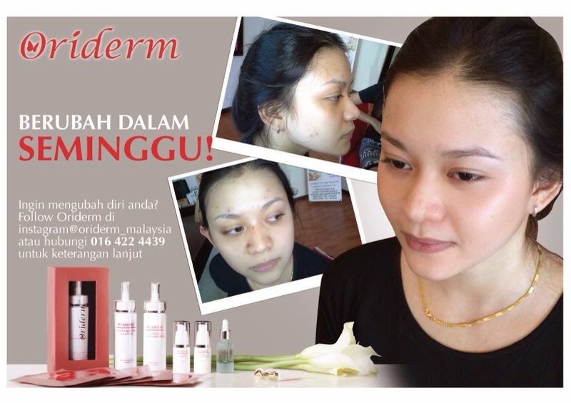 Experience the difference with Oriderm in 7 days! - ♥ Sabby Prue ...