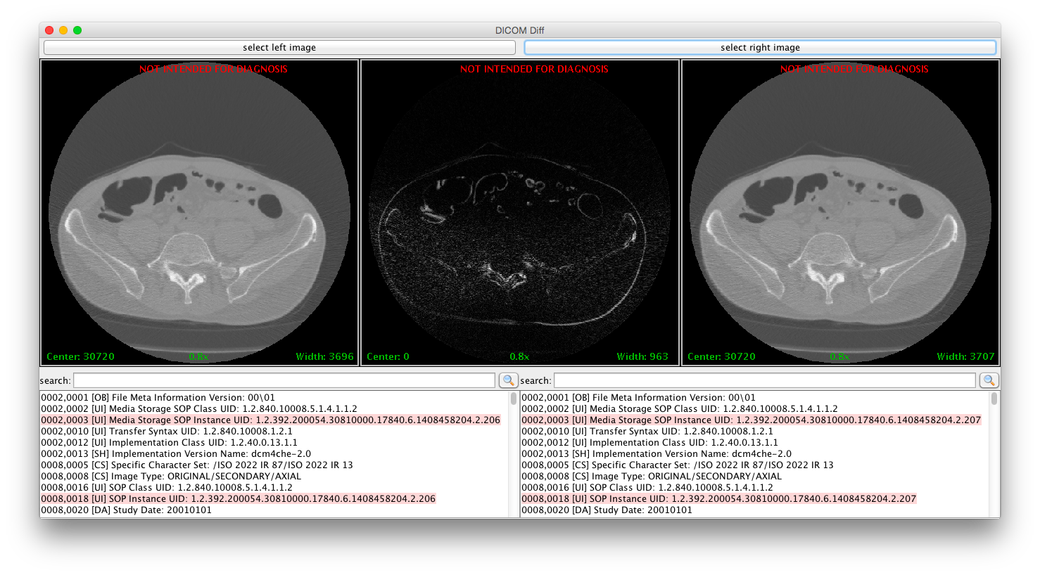 Compare DICOM images ）